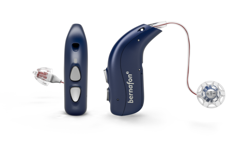 Bernafon Alpha Hearing Aids | The Hearing Specialist